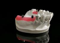 China CNC Precision Machining Custom Abutment Dental Implant For Missing One Or More Teeth for sale