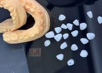 China High Translucency Custom Ceramic Veneer With Longevity 10 Plus Years In Dental for sale
