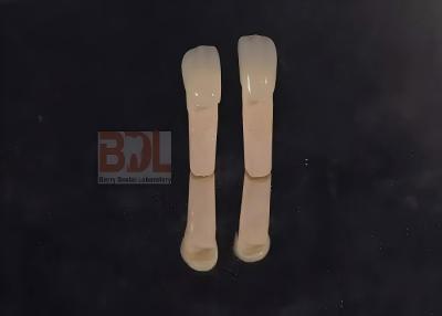 China High Fracture Toughness Ceramic Dentures with High Translucency and Low Thermal Conductivity for Dental Restorations for sale