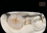 China High Translucency All-ceramic Restoration with High Fracture Toughness and CAD/CAM Compatibility for Dental Crowns for sale