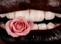 China Low Thermal Conductivity All Ceramic Dentures High Fracture Toughness Cementation for sale