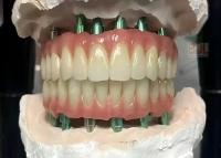 China Maloney Zirconia Bridge Implant Bar For Dental Restoration Custom No Foreign Body Sensation for sale