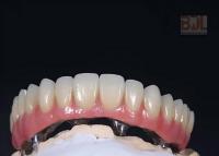 China Maloney Zirconia Bridge Implant Bar For Dental Restoration Custom No Foreign Body Sensation for sale