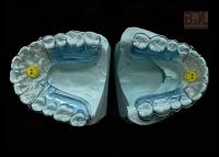 China Removable Orthodontic Appliance For Easy To Clean Convenient Removal With Worry Free Correction for sale