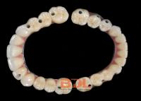 China Integrated Precision Machining Dental Zirconia Bridge With Grade 5 Titanium Alloy for sale
