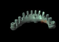 China 9mm 13mm 17mm  Dental Zirconia Bridge For Durable Dental Restoration for sale