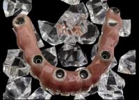 China Integrated Precision Machining Zirconia Bridge 3.2mm 4.0mm 4.8mm Dental Restoration Material for sale