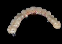 China Integrated Precision Machining Zirconia Bridge 3.2mm 4.0mm 4.8mm Dental Restoration Material for sale