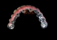 China Oral Restoration Integrated Precision Machining Dental Implant Solutions 9mm 13mm 17mm for sale