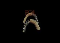 China Custom Manufactured 13mm Implant Bar For Optimal Bite Force Distribution for sale