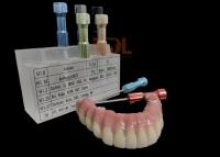 China Custom Manufactured 13mm Implant Bar For Optimal Bite Force Distribution for sale
