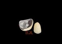 China Custom Color Matching PFM Porcelain Dental Prosthetics With Strong Metal Ceramic Bond for sale