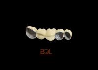 China Tooth Shade Matched Porcelain Fused To Metal Crown Featuring COCr Metal Construction for sale