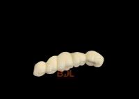 China Tooth Shade Matched Porcelain Fused To Metal Crown Featuring COCr Metal Construction for sale