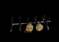 China Strong Metal Ceramic Bond Porcelain Fused To Metal Dental Restoration Good Biocompatibility for sale