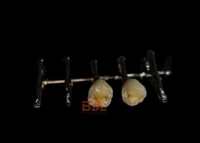 China Strong Metal Ceramic Bond Porcelain Fused To Metal Dental Restoration Good Biocompatibility for sale