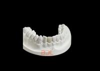 China Good Biocompatibility Tooth Shade Matched PFM Teeth PFM Dental Restoration for sale