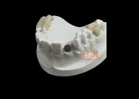 China Custom Porcelain Fused To Metal Strong Metal Ceramic Bond Thermal Expansion Coefficient Matched for sale