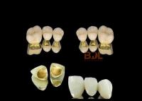 China Tooth Shade Matched PFM Crown Bridge Metal Alloy Base Porcelain Coating Precision for sale