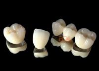 China Tooth Shade Matched PFM Crown Bridge Metal Alloy Base Porcelain Coating Precision for sale