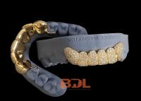 China Natural Tooth Appearance PFM Crown Dental Ceramic For Optimal Fit Exceptional Durability for sale