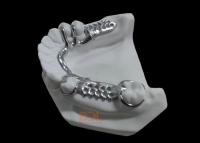 China Cobalt Chromium Partial Denture With High Biocompatibility Precise Fit For Long Term Reliability for sale