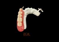 China HPP Dental Stents For Removable Partial Dentures Complete Dentures Implant Supported Dentures for sale
