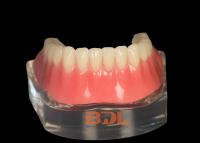 China Non Toxic Full Acrylic Dentures Made From Durable Acrylic Resin Adjustable for sale