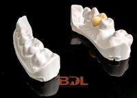 China Porcelain Fused To Metal Dental Restoration With Strong Metal Ceramic Bond Natural Tooth for sale