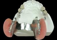 China Wear Resistant Dental Precision Attachments With High Retention Force Corrosion Resistant for sale