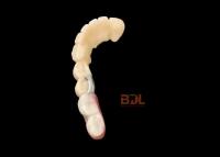 China Wear Resistant Dental Precision Attachments With High Retention Force Corrosion Resistant for sale