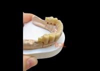 China Corrosion Resistant Dental Precision Attachments Custom To Patient’S Dental Anatomy for sale
