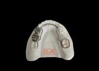 China Custom Dental Space Maintainers For Children 5-12 Years To Preserve Permanent Teeth Alignment for sale