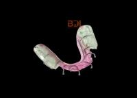 China Custom Adjustable Orthodontic Functional Appliances Safe For Oral Use In Pediatric Dental Growth for sale