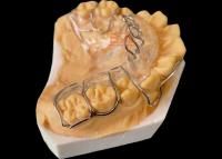 China Medical Grade Plastic Orthodontic Retainers Lightweight Comfortable For Teeth Retention for sale