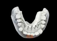 China Custom Fit Hypoallergenic Lightweight Orthodontic Retainers For Post Orthodontic Teeth for sale