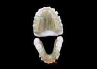 China Removable Orthodontic Retainers Lightweight Comfortable Fit For Orthodontic Care Dental for sale