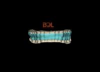 China Sports Gear Occlusal Splint Transparent Anti Snoring Appliance For Secure Jaw Alignment for sale