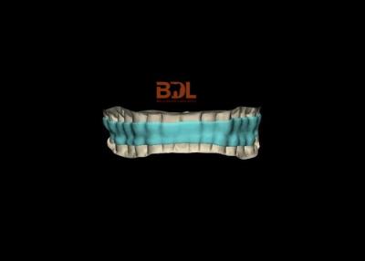 China Sports Gear Occlusal Splint Transparent Anti Snoring Appliance For Secure Jaw Alignment for sale