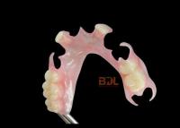 China Flexible Partial Dentures Removable Dental Prosthesis For Natural Teeth Support And Restoration for sale