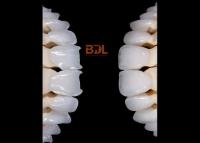 China Beige Matte Translucency Ceramic Dentures Providing Seamless Integration 400-600MPa for sale