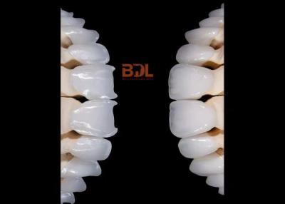 China Beige Matte Translucency Ceramic Dentures Providing Seamless Integration 400-600MPa for sale