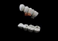 China Low Thermal Conductivity All Ceramic Dentures High Fracture Toughness Cementation for sale