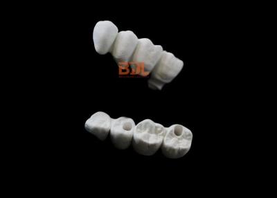 China Low Thermal Conductivity All Ceramic Dentures High Fracture Toughness Cementation for sale