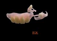 China High Comfort Flexible Partial Dentures With Natural Looking For Partial Tooth Replacement for sale