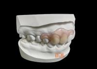 China High Comfort Flexible Partial Dentures With Natural Looking For Partial Tooth Replacement for sale