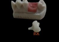China CNC Precision Machining Medical Implant Minimally Invasive Immediate Implantation for sale