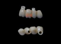China Zirconia Dental Implant Restores Tooth Function And Prevents Bone Absorption for sale