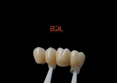 China Missing One Or More Teeth Implant CNC Precision Machining Occlusal Loading Time 6 Weeks for sale