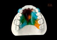 China Comfortable To Wear Orthodontic Expander Easy Clean For Precise Orthodontic Correction for sale